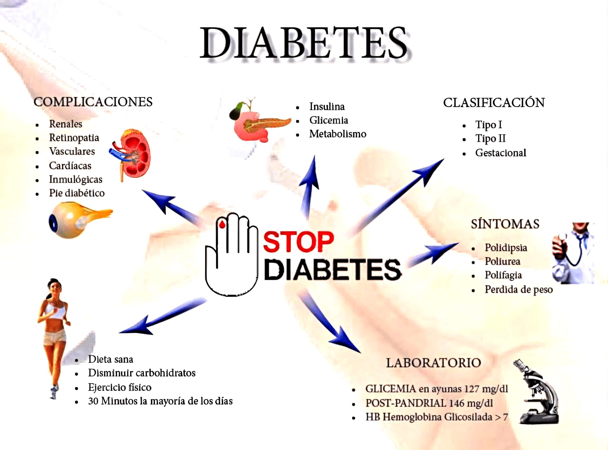 MAPA MENTAL SOBRE DIABETES - Maps4Study